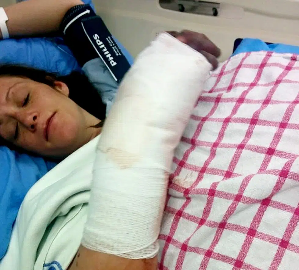 Woman losing fingers, claims mistreatment at Regina hospital | paNOW