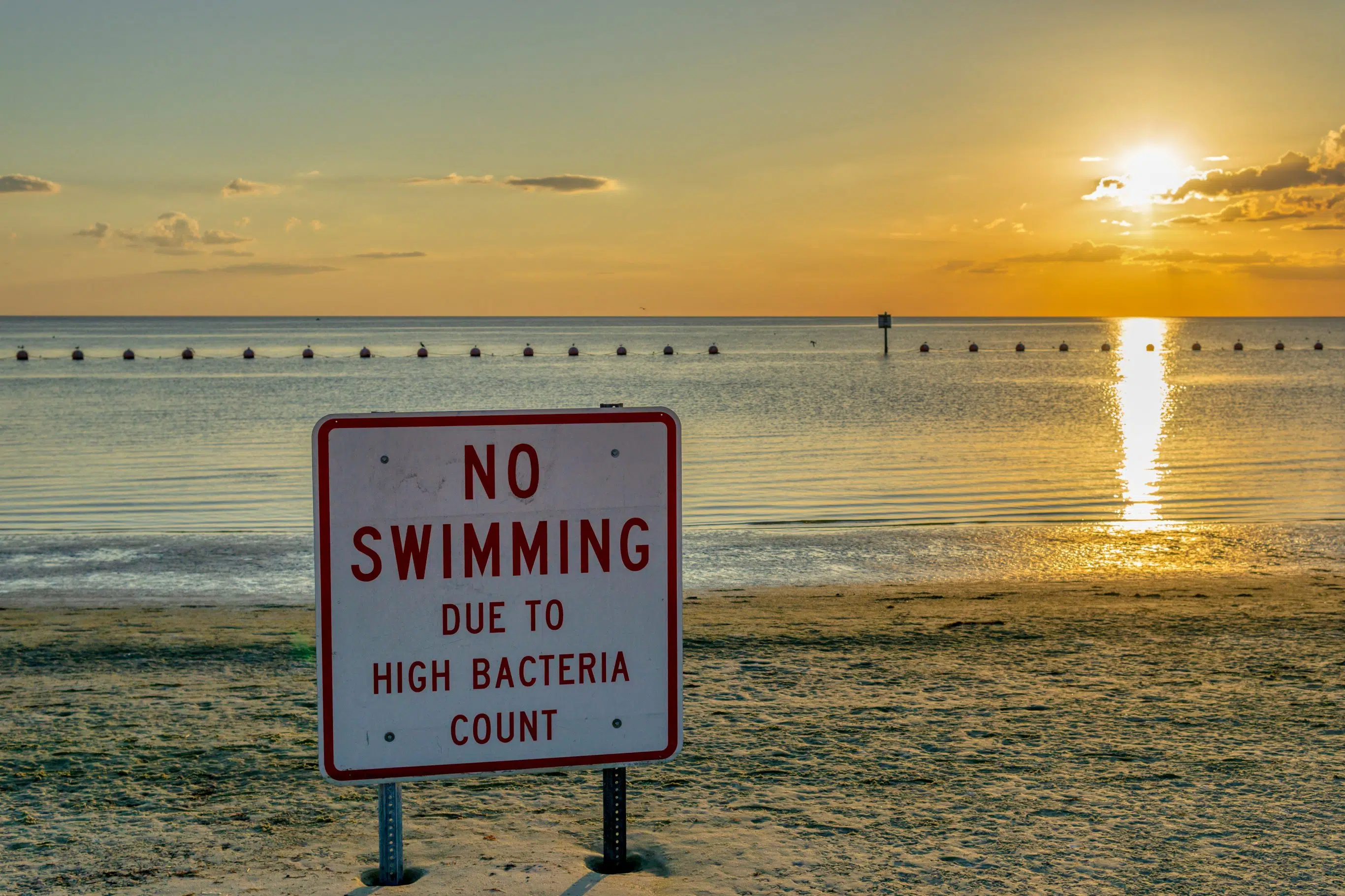 EPA Samples Show How Bacteria Can Ruin a Day at the Beach | Seehafer News