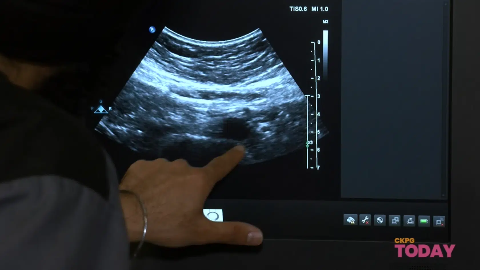 Taking a Look Inside With CNC’s Sonography Program | CKPGToday.ca